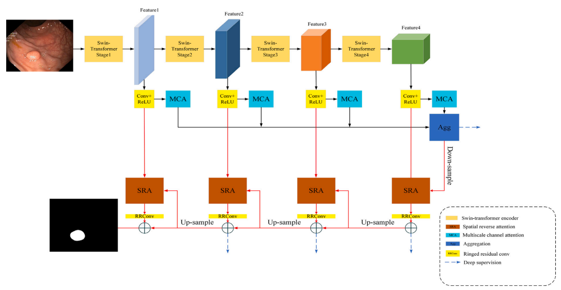 【结肠息肉AI论文集】MSRAformer: Multiscale spatial reverse attention network for polyp segmentation-CSDN博客