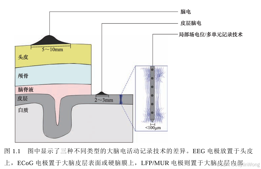 脑电信号处理与提取总结-CSDN博客
