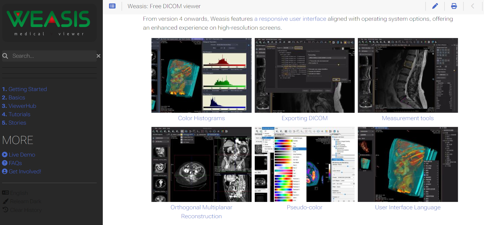 开源影像浏览工具Weasis-CSDN博客