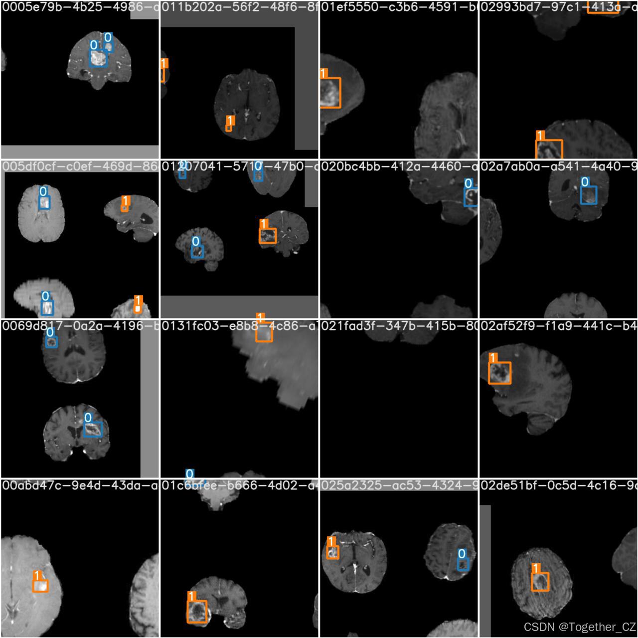 赋能医学影像，AI助力智能化辅助诊断，基于YOLOv3全系列【yolov3tiny/yolov3/yolov3spp】参数模型开发构建磁共振成像、CT扫描场景下医学图像脑肿瘤检测识别系统_人工 ...