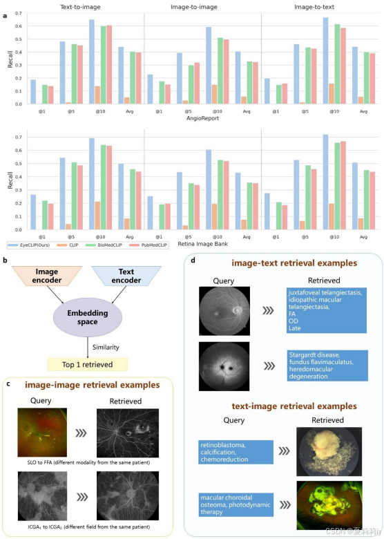 [arXiv 2024]EyeCLIP: A visual-language foundation model for multi-modal ophthalmic image ...