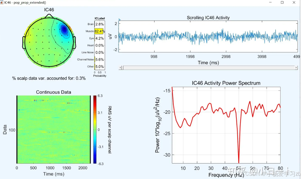 脑机接口--matlab伪迹的简单判别_脑电ica伪迹判定-CSDN博客