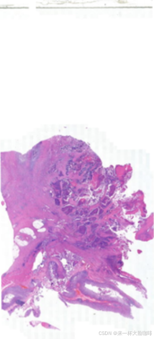 Deepzoom和Openslide处理WSI时的异同及问题解决_openslide读取wsi-CSDN博客