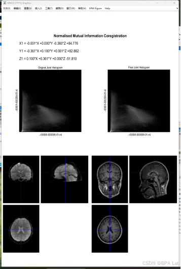 【入门且详细！fMRI信号预处理操作流程笔记】SPM12版_spm12入门教程-CSDN博客