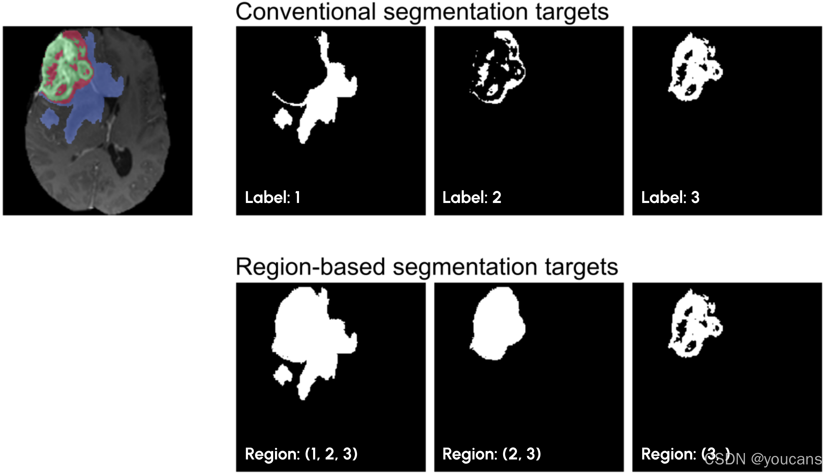 【医学影像 AI】nnU-Net 从下载到使用-CSDN博客