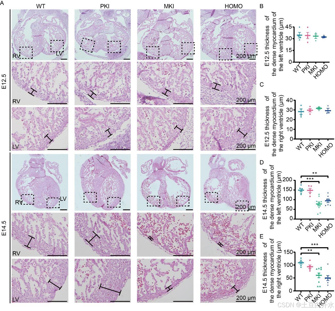 LncRNAs in the Dlk1-Dio3 Domain Are Essential for Mid-Embryonic Heart ...
