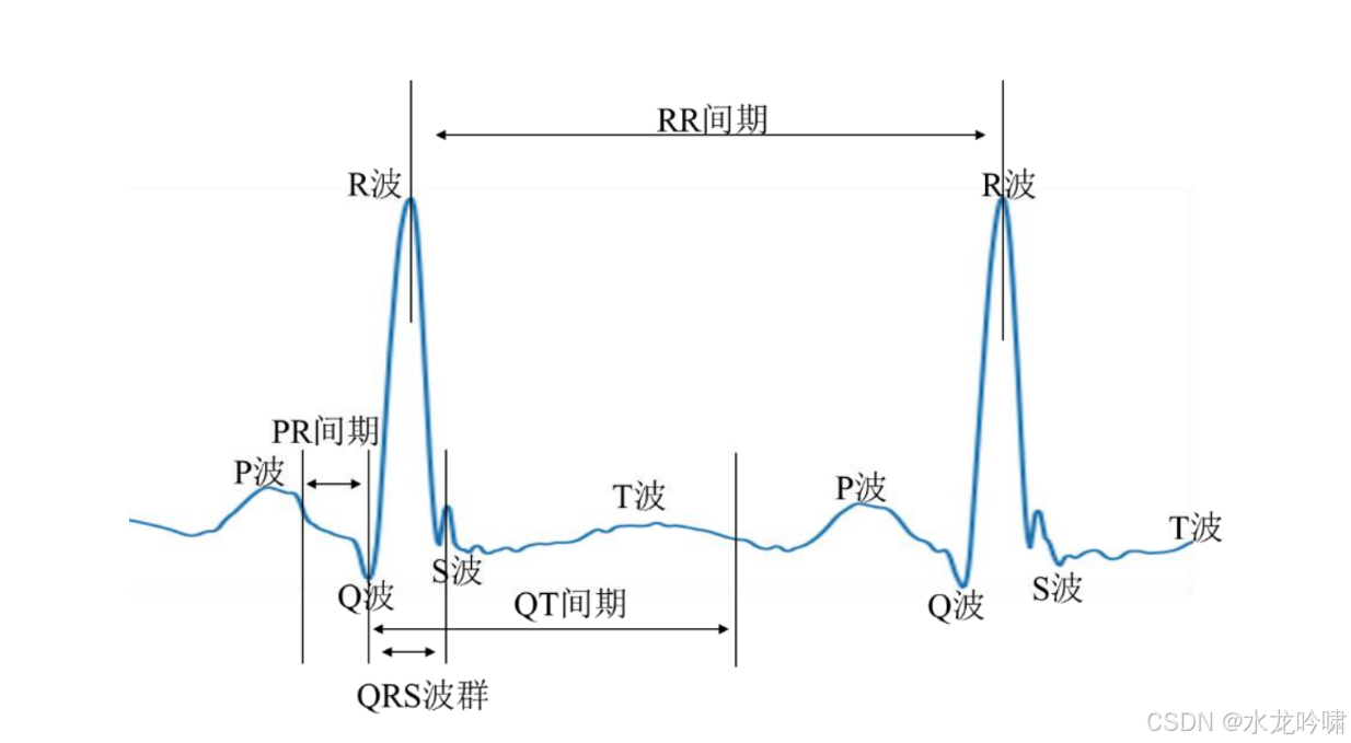 信号与系统工程实践--ECG（心电图）_ecg信号-CSDN博客