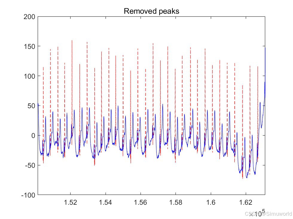 基于带通滤波的ECG信号P波检测matlab仿真-CSDN博客