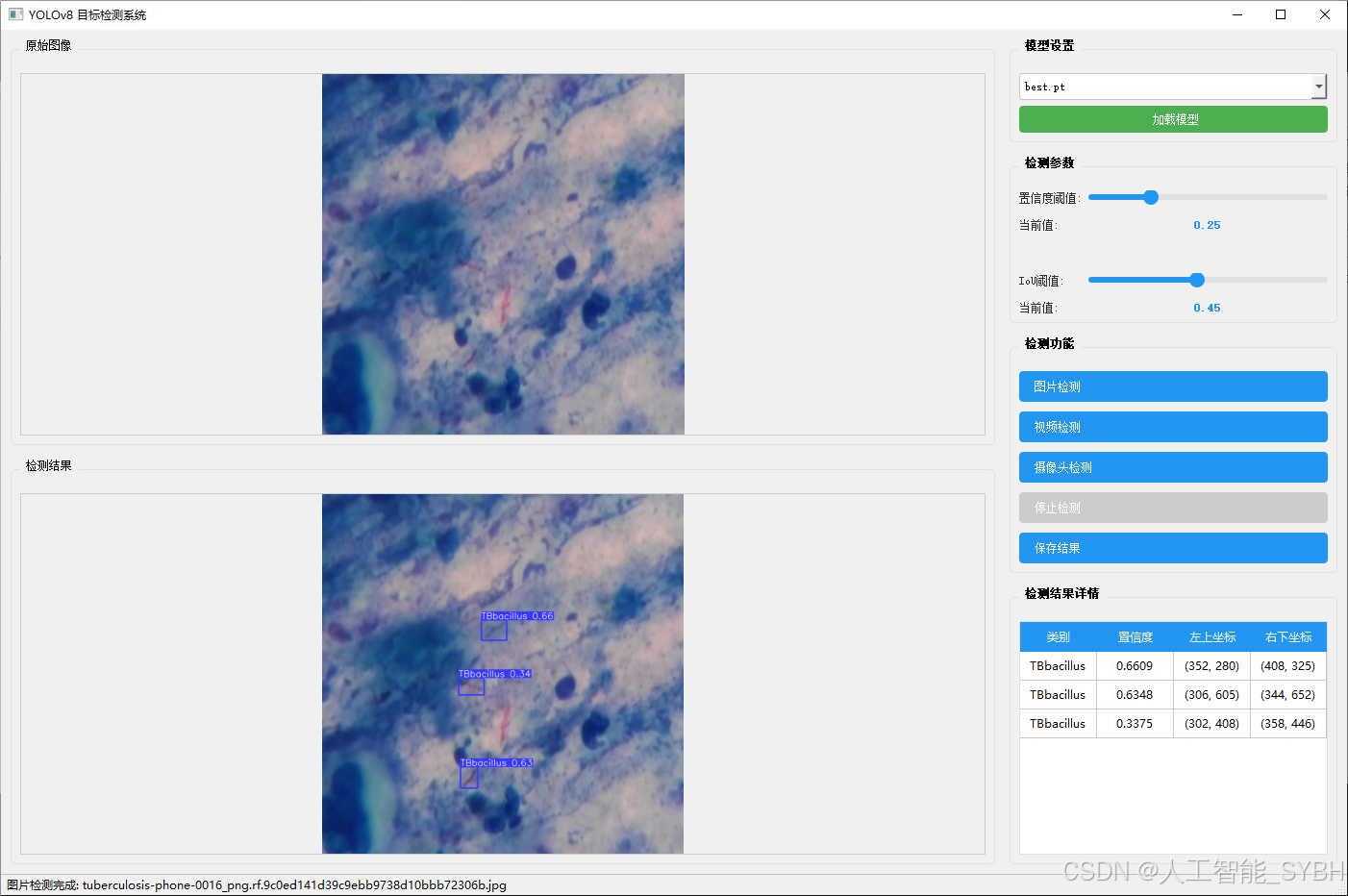 基于深度学习的结核病检测系统（YOLOv8+YOLO数据集+UI界面+Python项目+模型）_结核杆菌数据集-CSDN博客