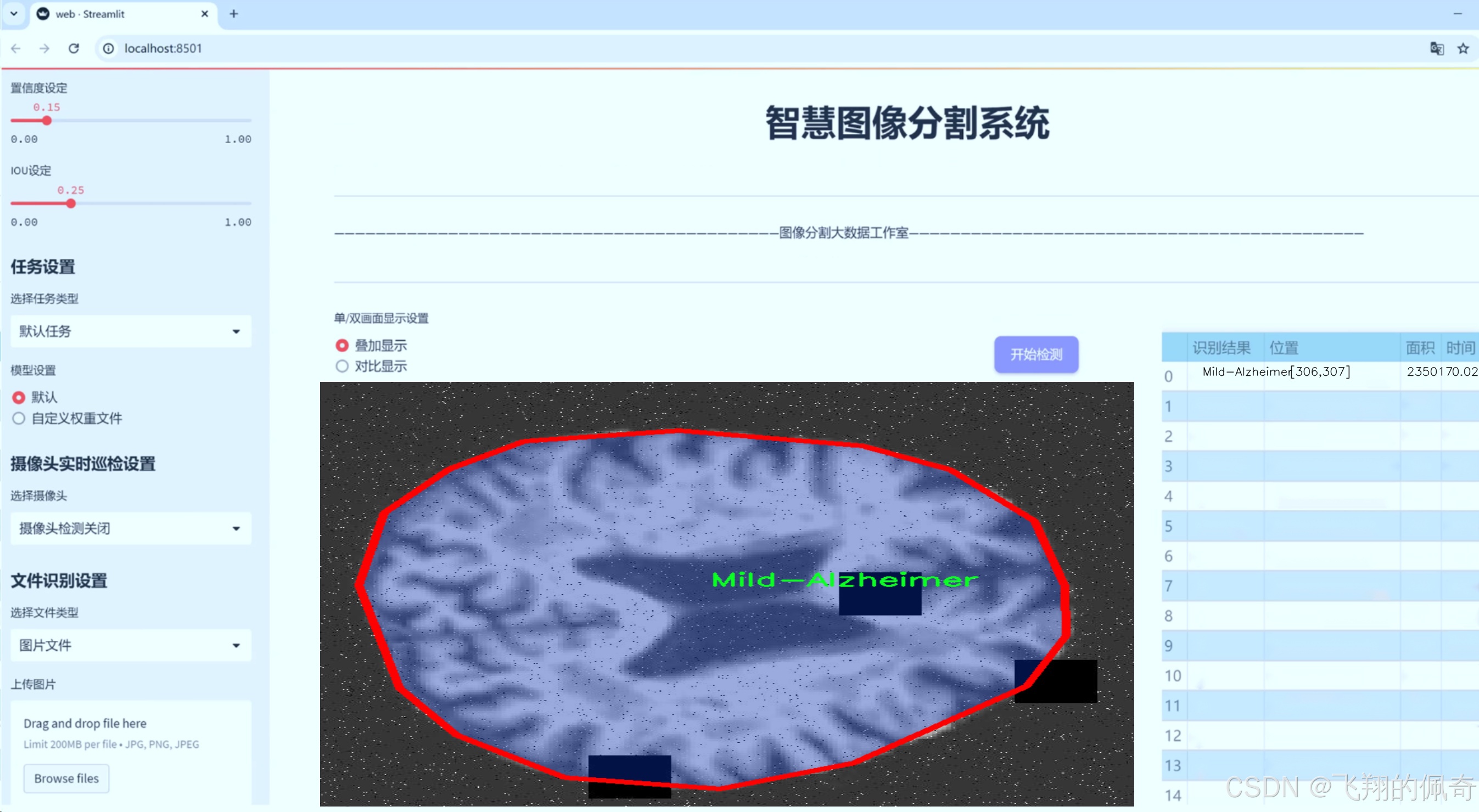 【完整源码+数据集+部署教程】阿尔茨海默症图像分割系统源码＆数据集分享 [yolov8-seg-convnextv2＆yolov8-seg ...