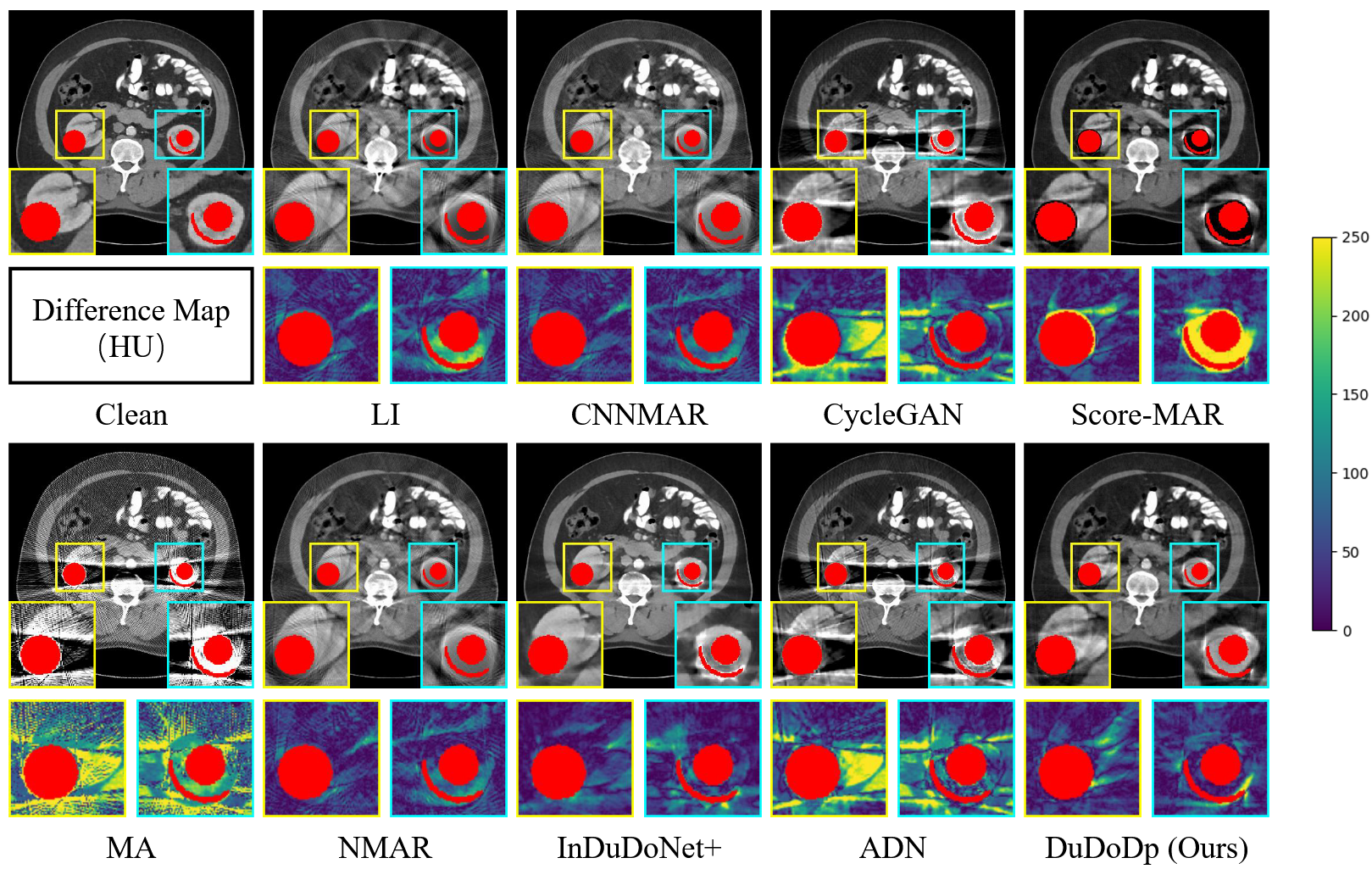 Unsupervised CT Metal Artifact Reduction by Plugging Diffusion Priors ...