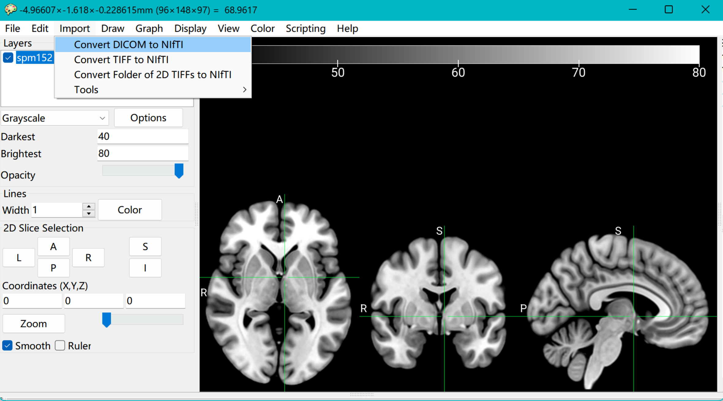dcm转nii，Dicom转Nifti的几种方法-CSDN博客