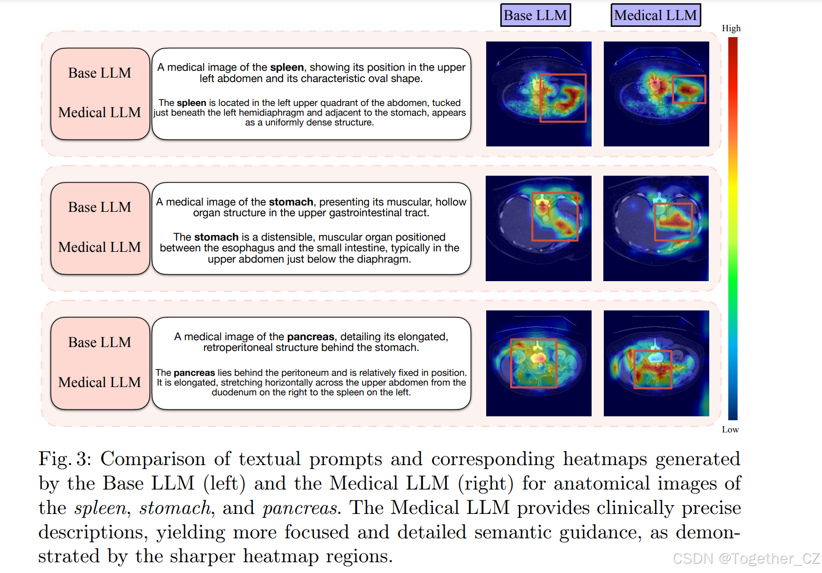 PG-SAM: Prior-Guided SAM with Medical for Multi-organ Segmentation——用于多 ...