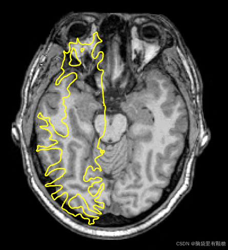 Workbench View 可视化(FreeSurfer2Workbench)问题小结_freesurfer 可视化-CSDN博客