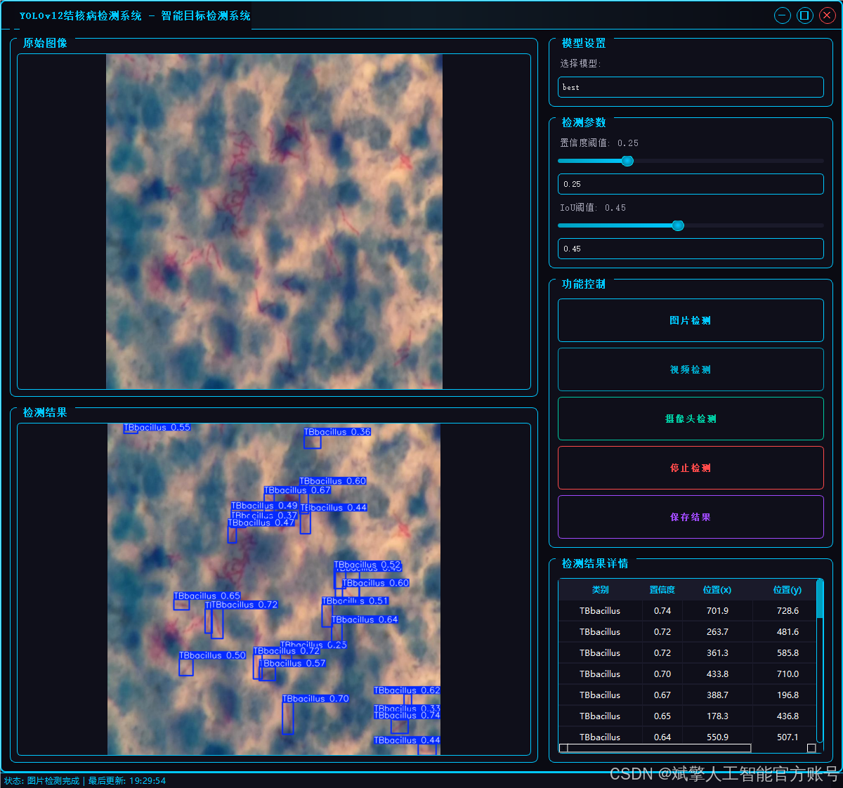 基于深度学习YOLOv12的结核病检测系统（YOLOv12+YOLO数据集+UI界面+登录注册界面+Python项目源码+模型）-CSDN博客