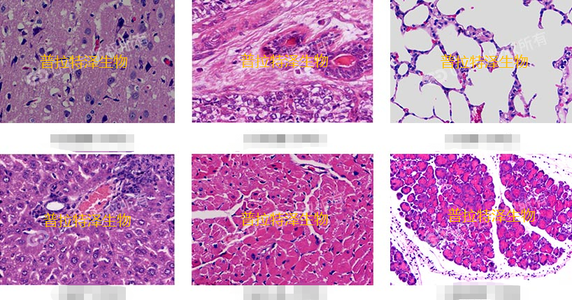 免疫组化与HE染色结果怎么看？_he染色 知乎-CSDN博客