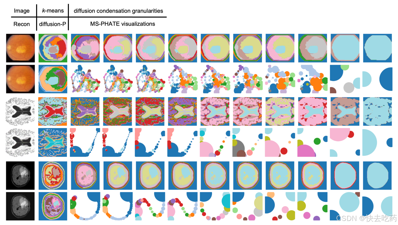 CUTS: A Deep Learning and TopologicalFramework for MultigranularUnsupervised Medical Image ...