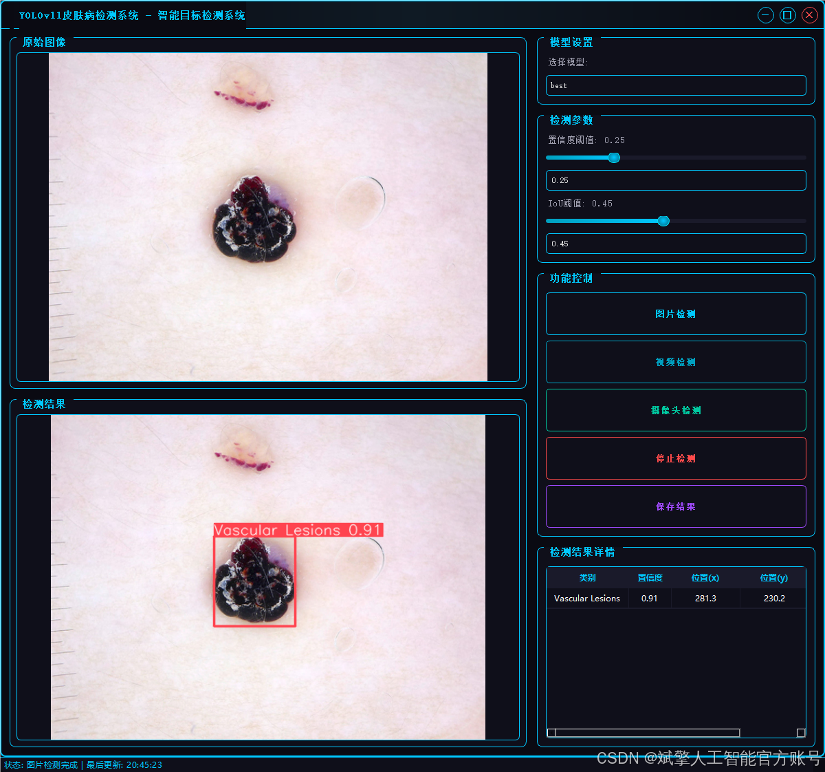 基于深度学习YOLOv11的皮肤病识别检测系统（YOLOv11+YOLO数据集+UI界面+登录注册界面+Python项目源码+模型）-CSDN博客
