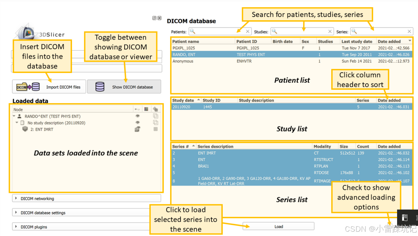 3D Slicer 教程四 ---- 基本功能介绍(一)_3dslicer有哪些功能-CSDN博客