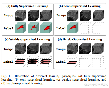 Rethinking Barely-Supervised Segmentation from an Unsupervised Domain Adaptation Perspective 阅读 ...