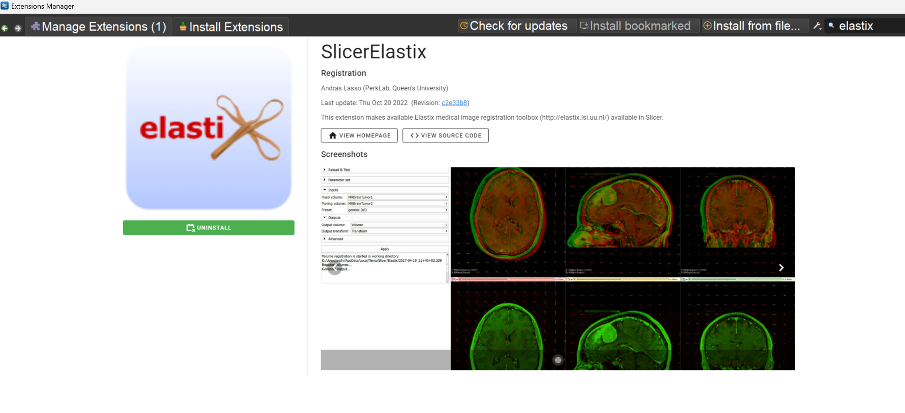 Elastix医学图像配准全攻略_pyelastix支持nii.gz吗-CSDN博客