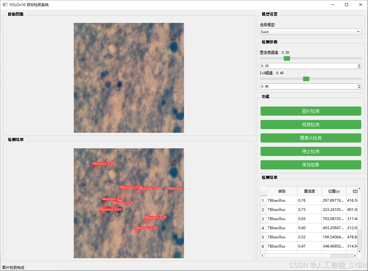 基于深度学习YOLOv10的结核病检测系统（YOLOv10+YOLO数据集+UI界面+Python项目源码+模型）_结核杆菌检测ui界面图片pyqt5-CSDN博客