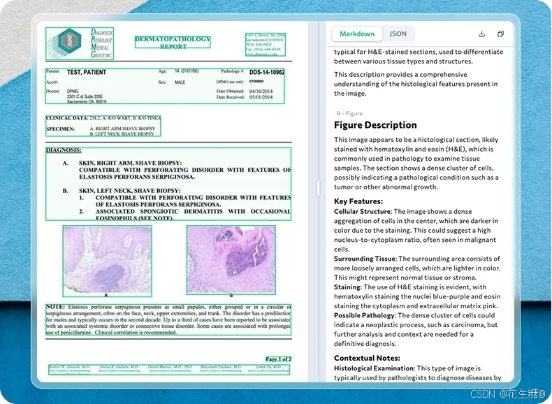 Agentic-Doc：从复杂文档中提取结构化数据的强大Python库-CSDN博客
