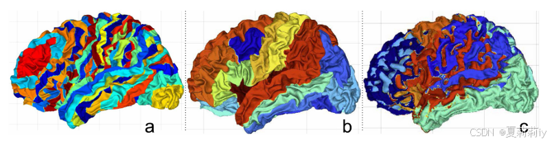 [TPAMI 2022]Learnable Pooling in Graph Convolutional Networks for Brain Surface Analysis-CSDN博客