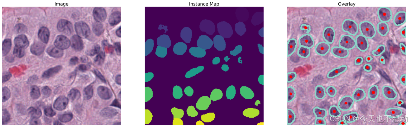 HoVer-Net_实操与文章应用思路_hovernet-CSDN博客