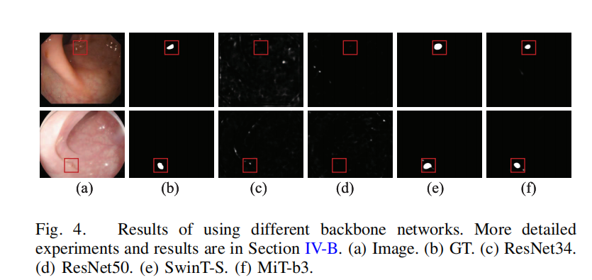 CTNet: Contrastive Transformer Networkfor Polyp Segmentation-CSDN博客