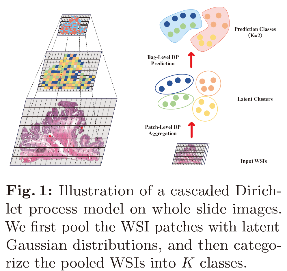 论文128：cDP-MIL: Robust multiple instance learning via cascaded Dirichlet process (ECCV‘25 开源)-CSDN博客