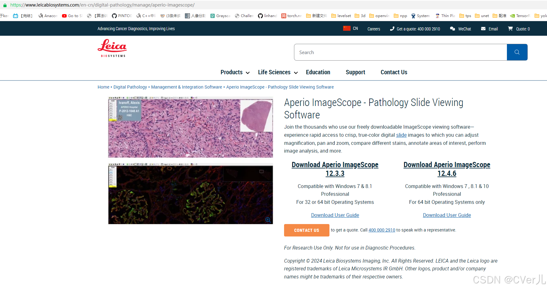 openslide处理显微镜病理SVS切片_aperio imagescope-CSDN博客