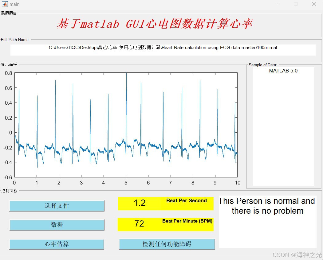 【ecg心电信号】基于matlab Gui心电图数据计算心率（含判断）【含matlab源码 11080期】 Csdn博客 
