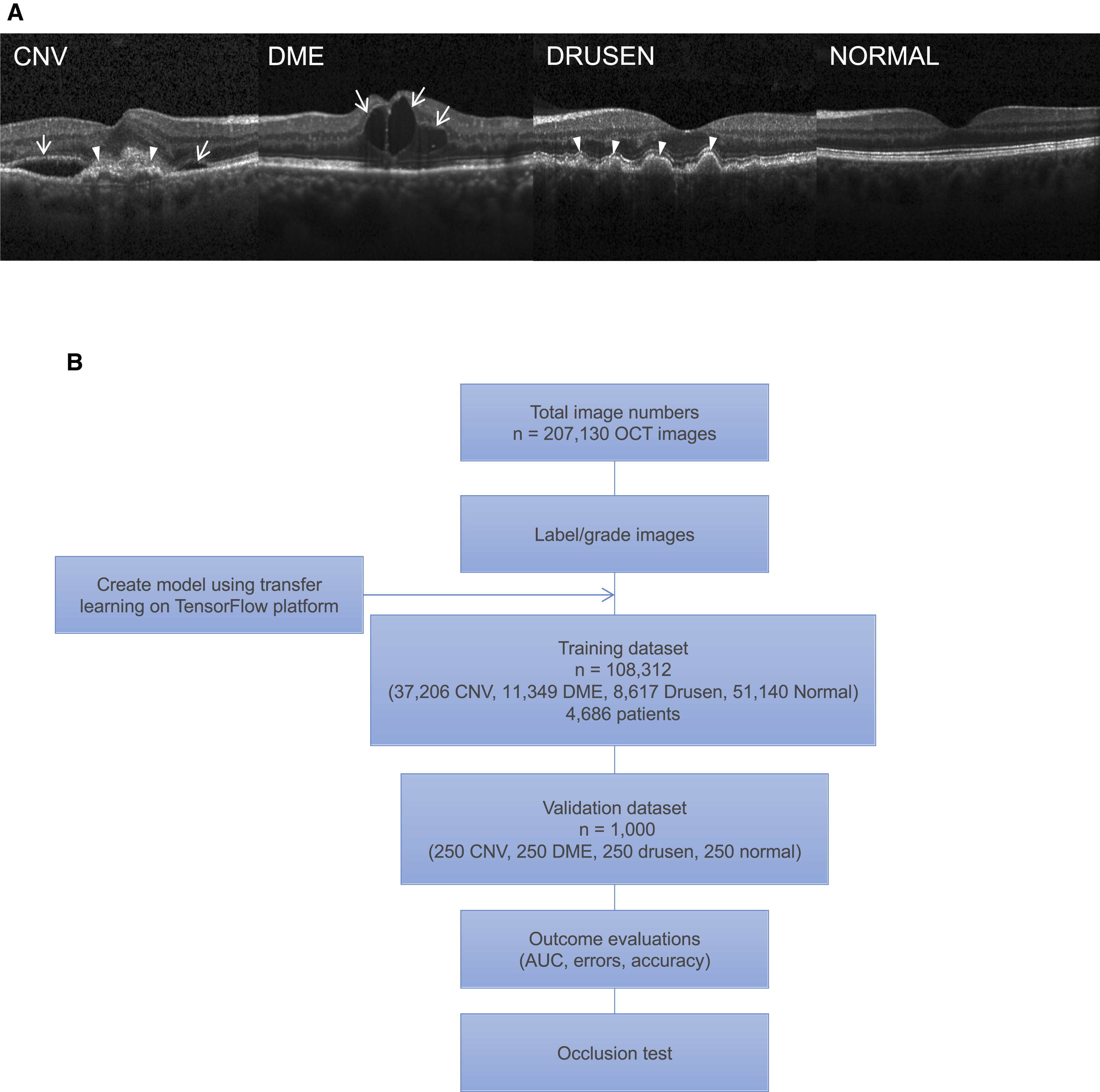 常见的 OCT 眼底疾病数据集(OCT2017、Eye OCT Datasets、OCTDL、RetinalOCT_Dataset-C8、RETOUCH和OCTA-500)_octdl数据集 ...