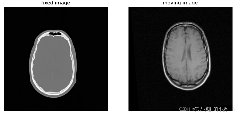 simpleITK - Registration - SimpleITKv4配准简介_simpleitk图像配准-CSDN博客