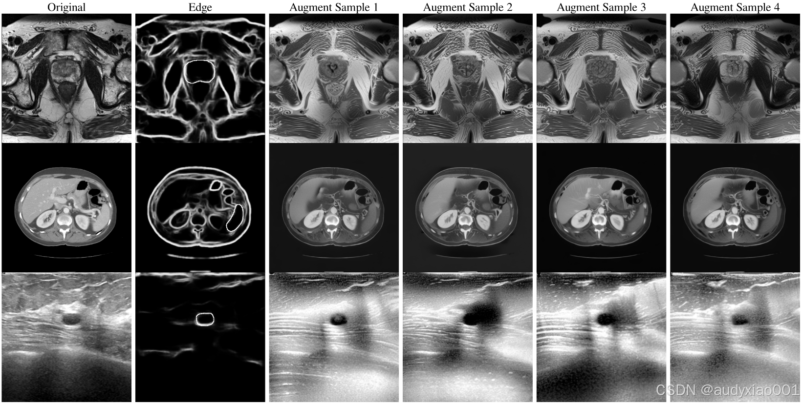 Diffboost：通过文本引导的扩散模型增强医学图像分割 Csdn博客