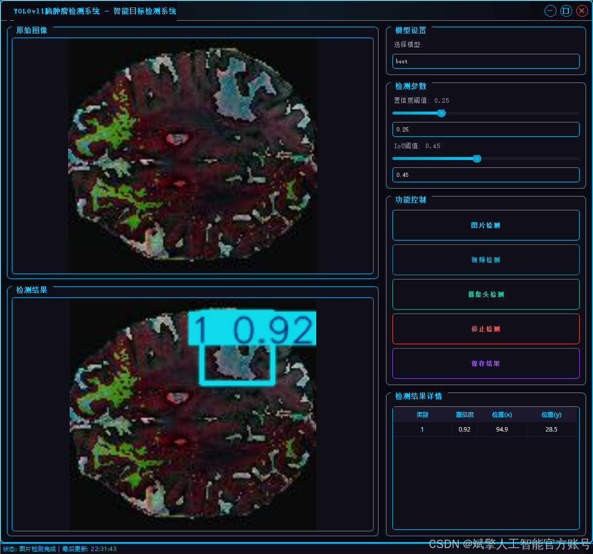 基于深度学习YOLOv11的脑肿瘤检测系统（YOLOv11+YOLO数据集+UI界面+登录注册界面+Python项目源码+模型）-CSDN博客