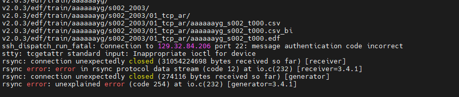 TUH EEG公开数据集下载方法_tuh eeg seizure corpus(tusz)-CSDN博客