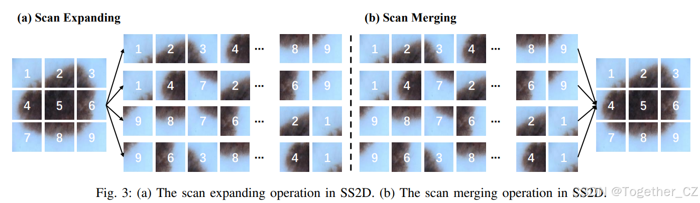 VM-UNet: Vision Mamba UNet for Medical Image Segmentation——用于医学图像分割的视觉Mamba UNet-CSDN博客
