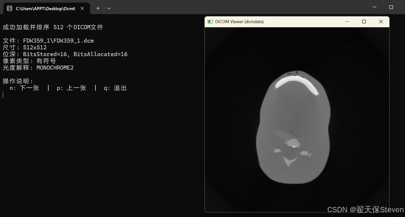 DCMTK-读取DICOM图像数据_dcmtk库使用-CSDN博客