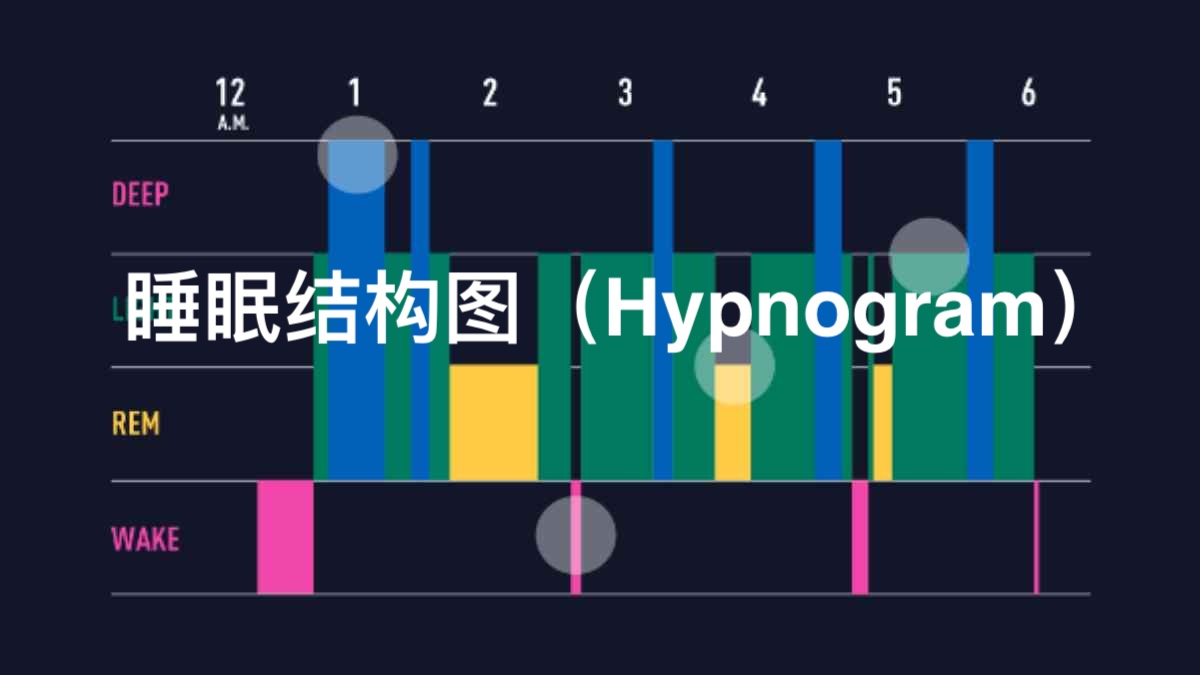 睡眠结构图（Hypnogram）-CSDN博客