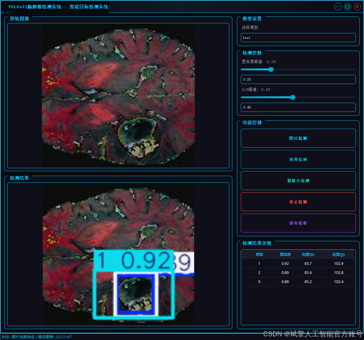 基于深度学习YOLOv11的脑肿瘤检测系统（YOLOv11+YOLO数据集+UI界面+登录注册界面+Python项目源码+模型）-CSDN博客