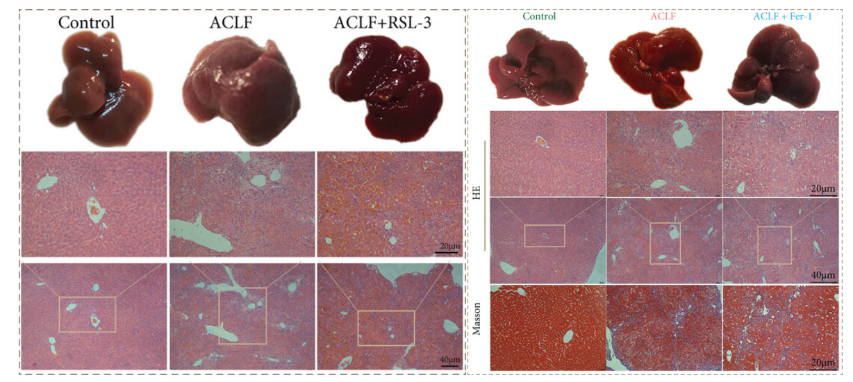 AbMole | 细胞铁死亡（Ferroptosis）-高引抑制剂、诱导剂及检测方法全解析_zvad和铁死亡-CSDN博客