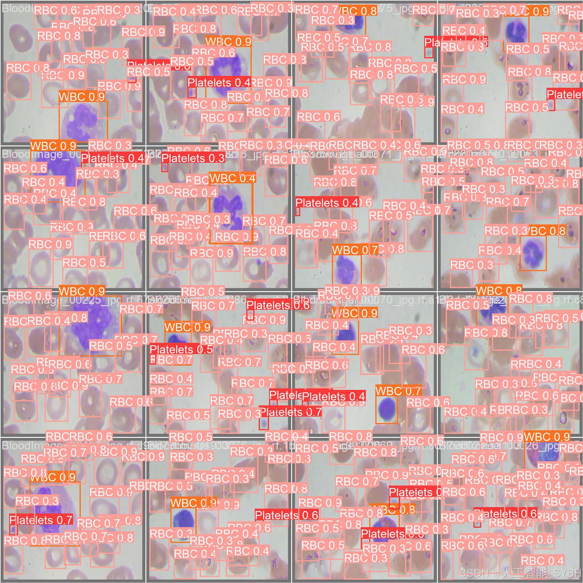 基于深度学习YOLOv10的红细胞、白细胞和血小板检测系统（YOLOv10+YOLO数据集+UI界面+Python项目源码+模型）-CSDN博客