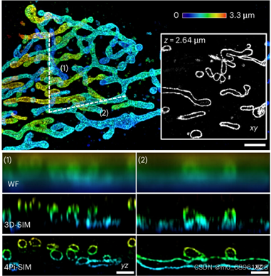 细胞成像的超级“放大镜”——4Pi-SIM_3d-sim ppt-CSDN博客