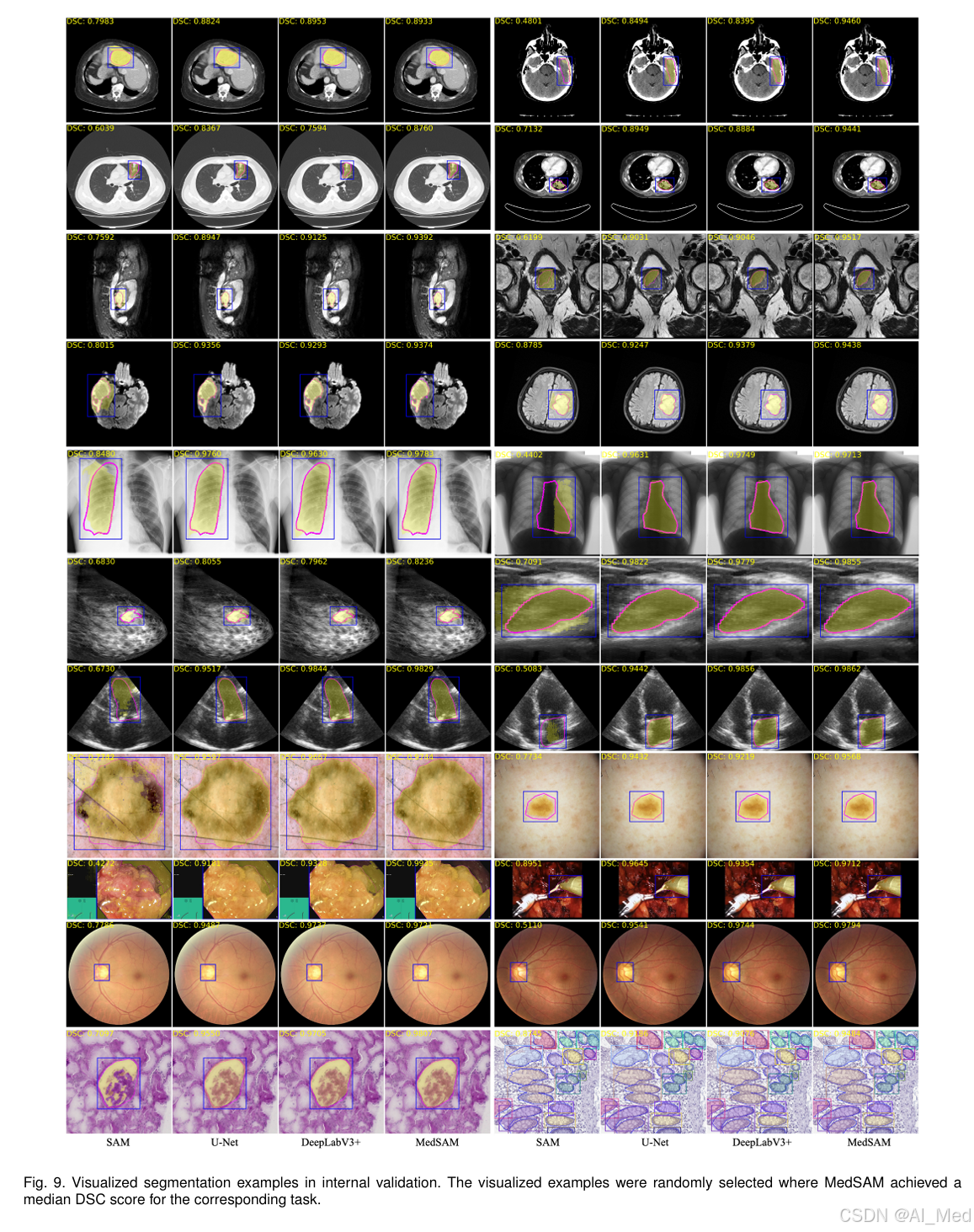 【SAM医学分割】MedSAM分割医学图像中的任何内容-CSDN博客