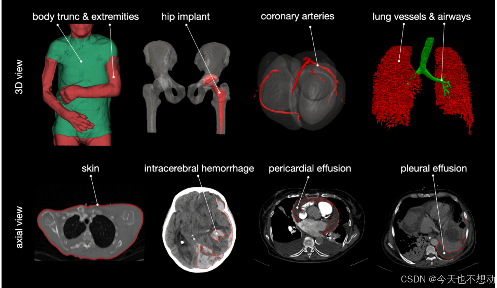 Python版：TotalSegmentator 安装与使用指南-CSDN博客