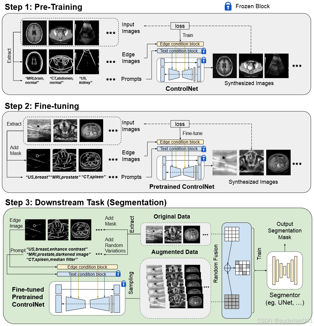 DiffBoost：通过文本引导的扩散模型增强医学图像分割-CSDN博客