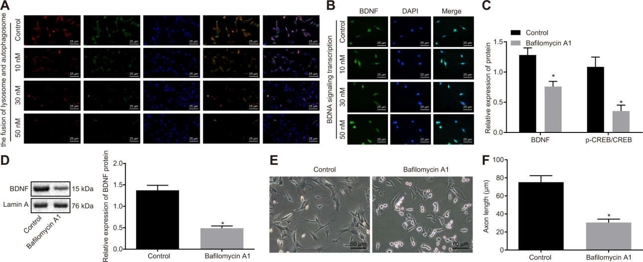 AbMole小课堂 | 如何阻断自噬？试试Bafilomycin A1！_bafilomycin a1处理细胞抑制自噬-CSDN博客