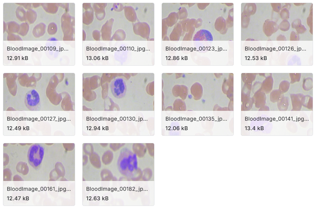 【CV数据集介绍-26】BCCD：血细胞检测数据集_bccd数据集-CSDN博客